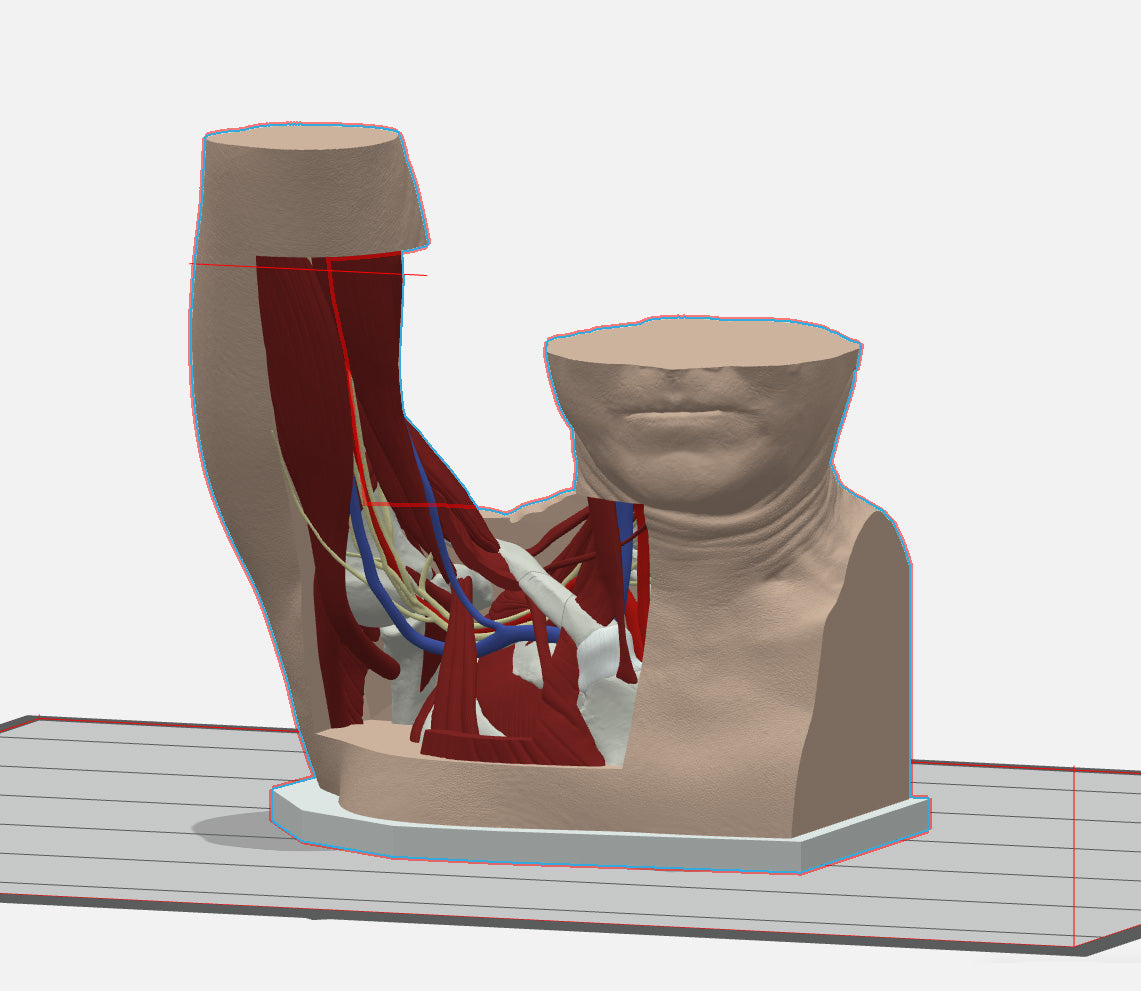 Custom 3D Anatomy Models | Thoracic Outlet Syndrome (TOS) | Thoracic ...
