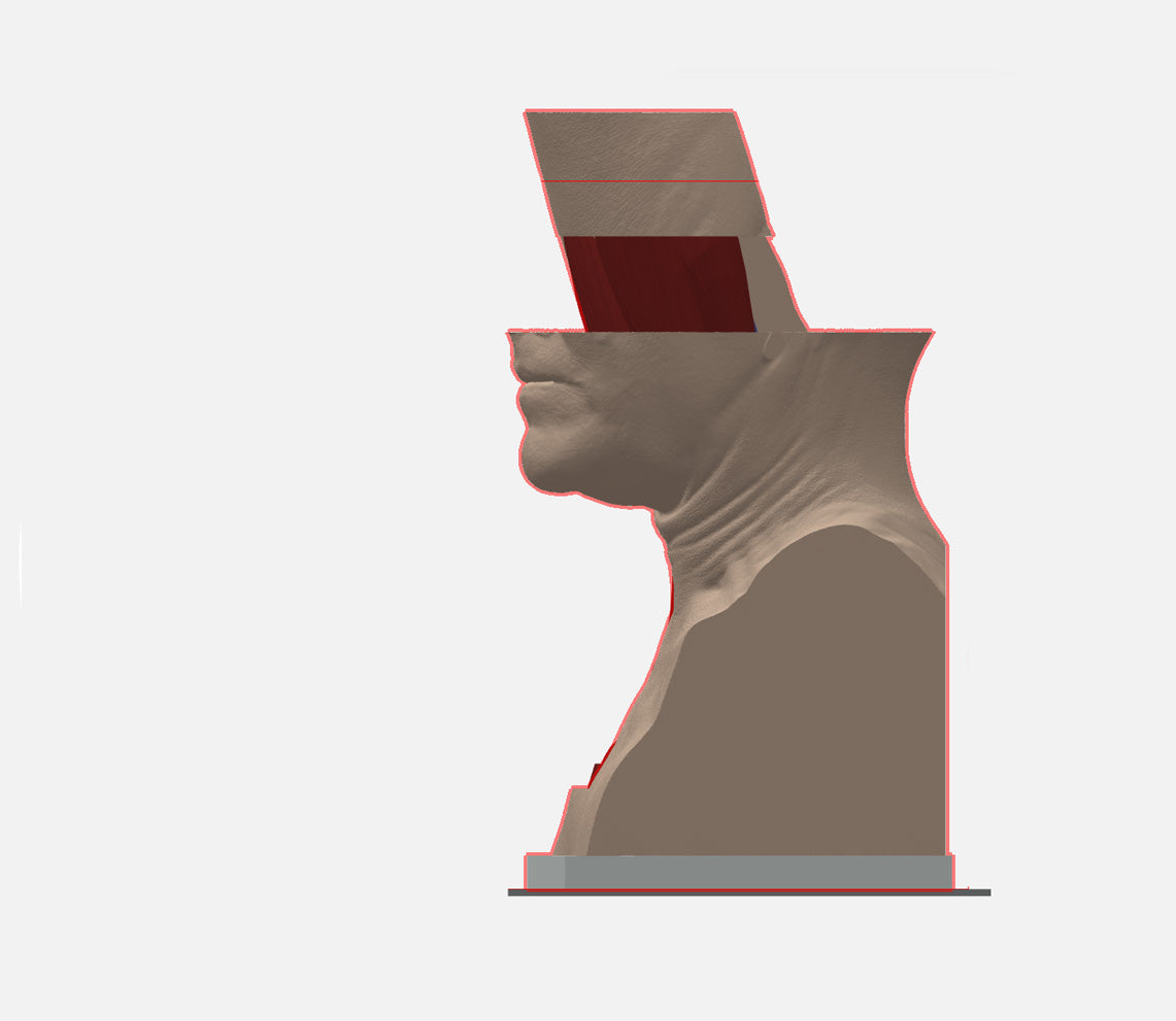 Custom 3D Anatomy Models | Thoracic Outlet Syndrome (TOS) | Thoracic ...