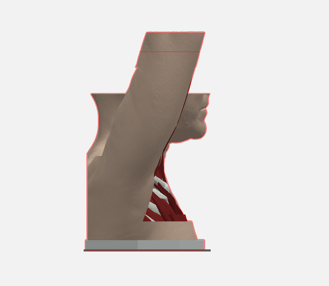 Custom 3D Anatomy Models | Thoracic Outlet Syndrome (TOS) | Thoracic ...