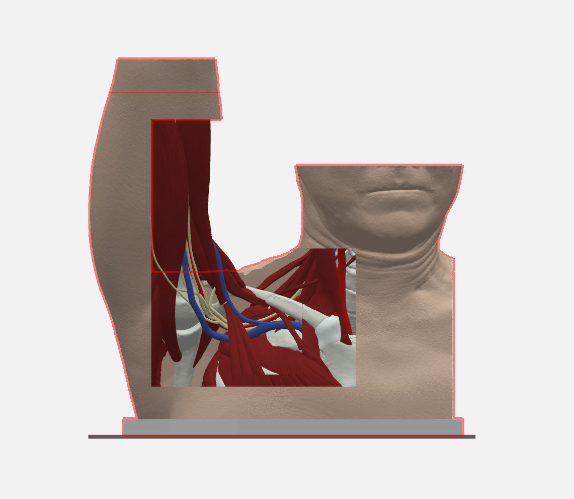Custom 3D Anatomy Models | Thoracic Outlet Syndrome (TOS) | Thoracic ...
