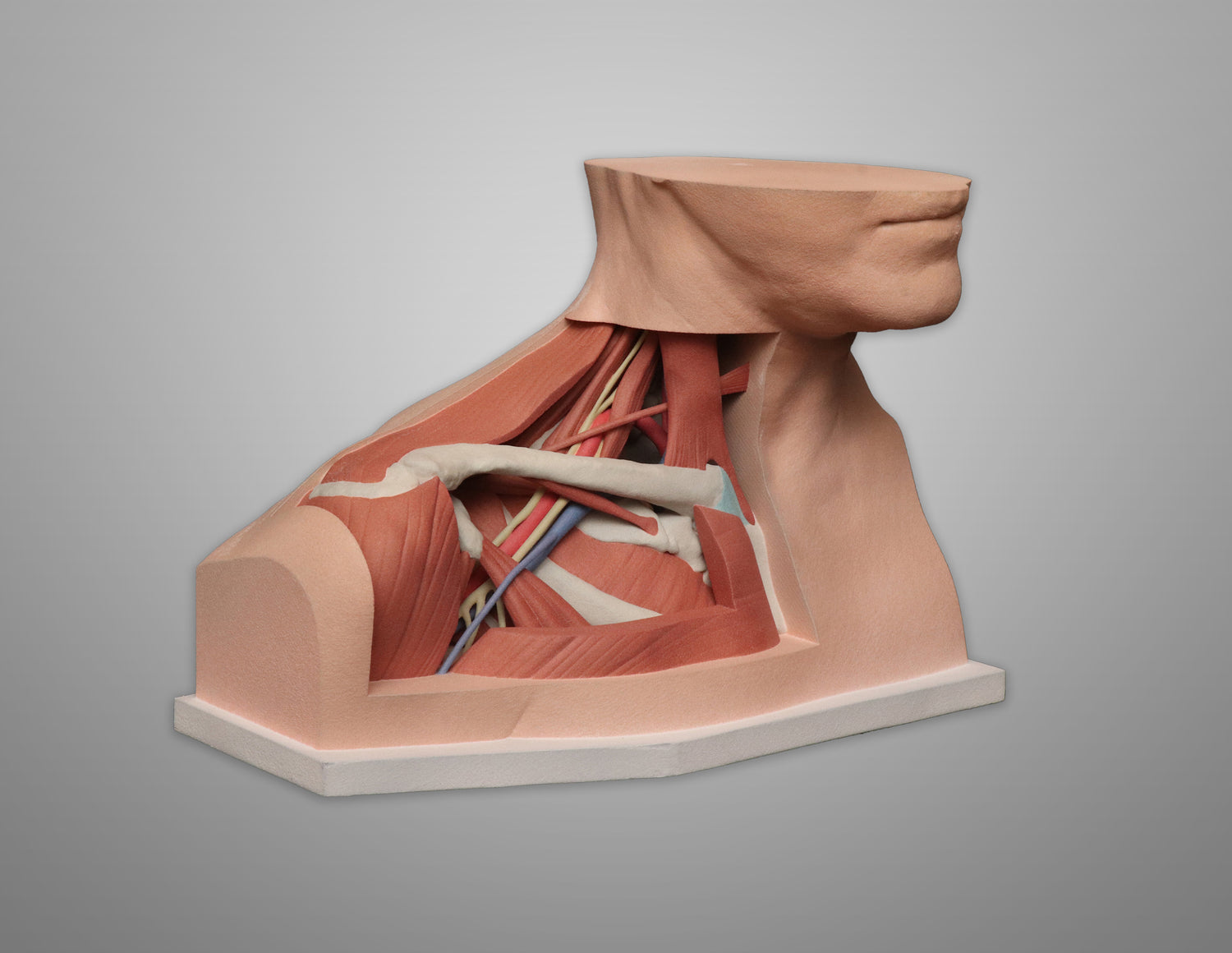Custom 3D Anatomy Models | Thoracic Outlet Syndrome (TOS) | Thoracic ...