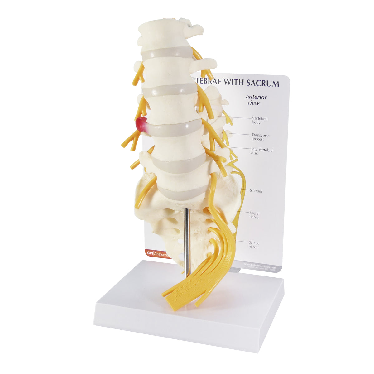 5-Piece Vertebrae Model with Sacrum – GPI 3D Anatomy