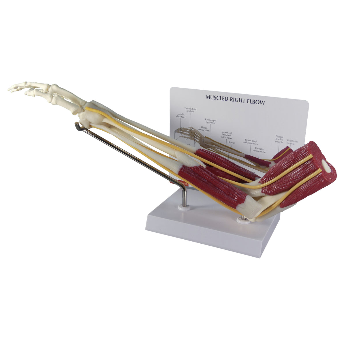 Muscled Elbow Model – GPI 3D Anatomy