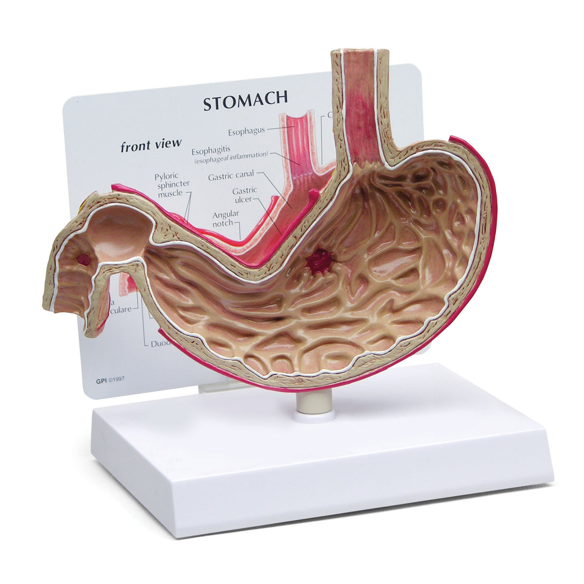 Stomach Model – GPI 3D Anatomy