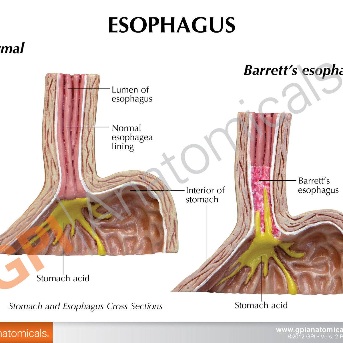 4-Piece Stomach Education Card – GPI 3D Anatomy