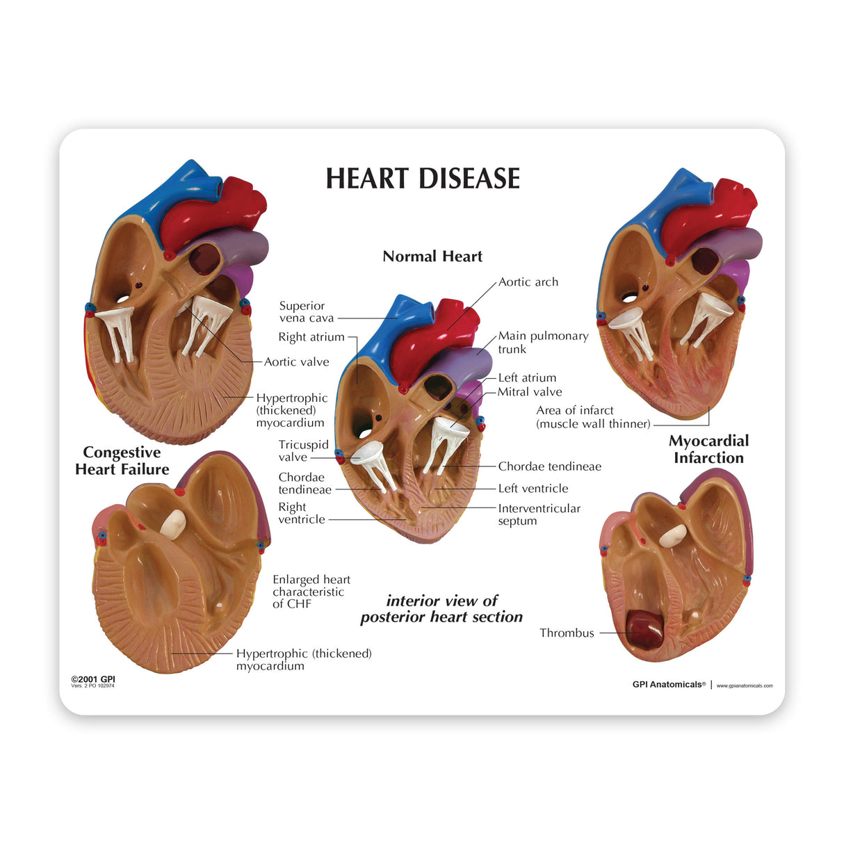 3-Piece Mini Heart Model Set – GPI 3D Anatomy