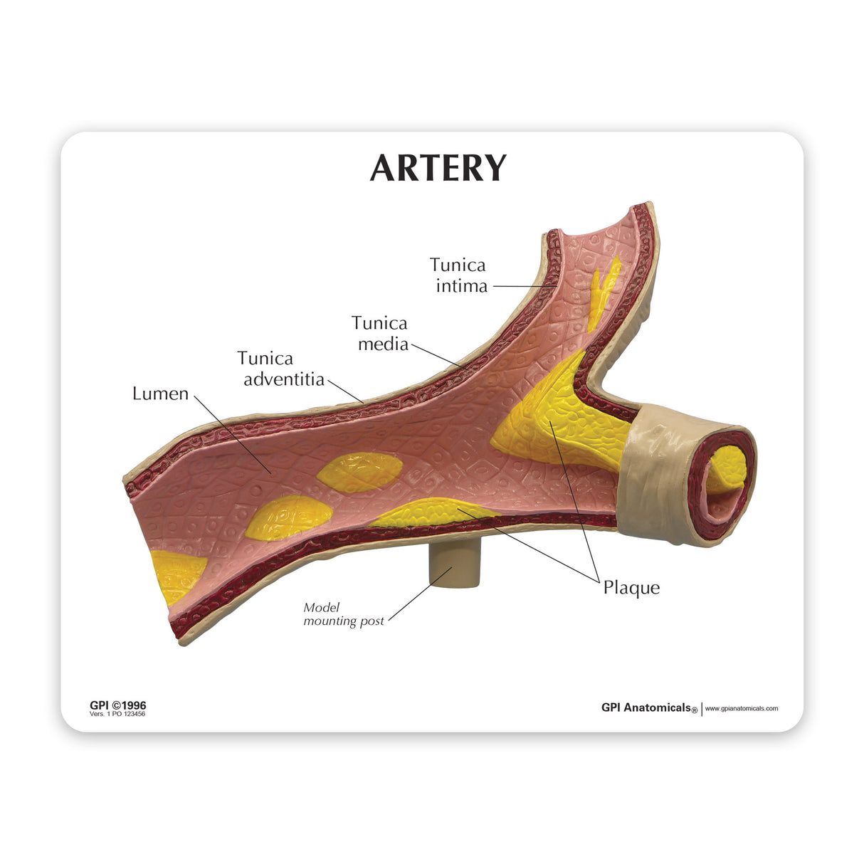 Artery Model – GPI 3D Anatomy
