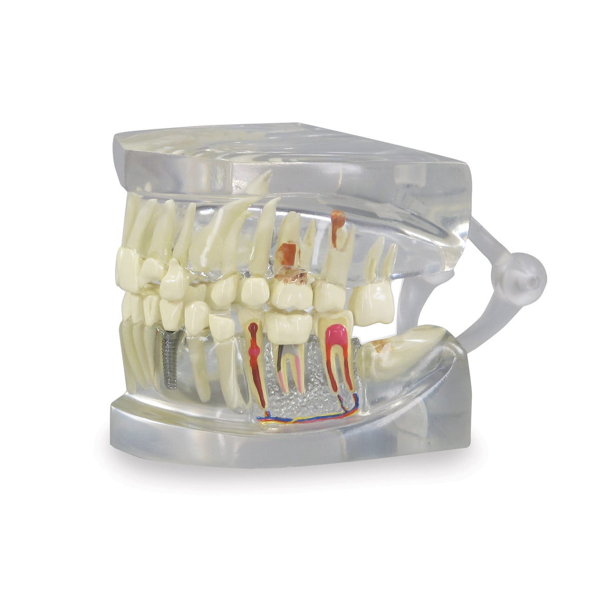 Teeth Model, Clear – GPI 3D Anatomy