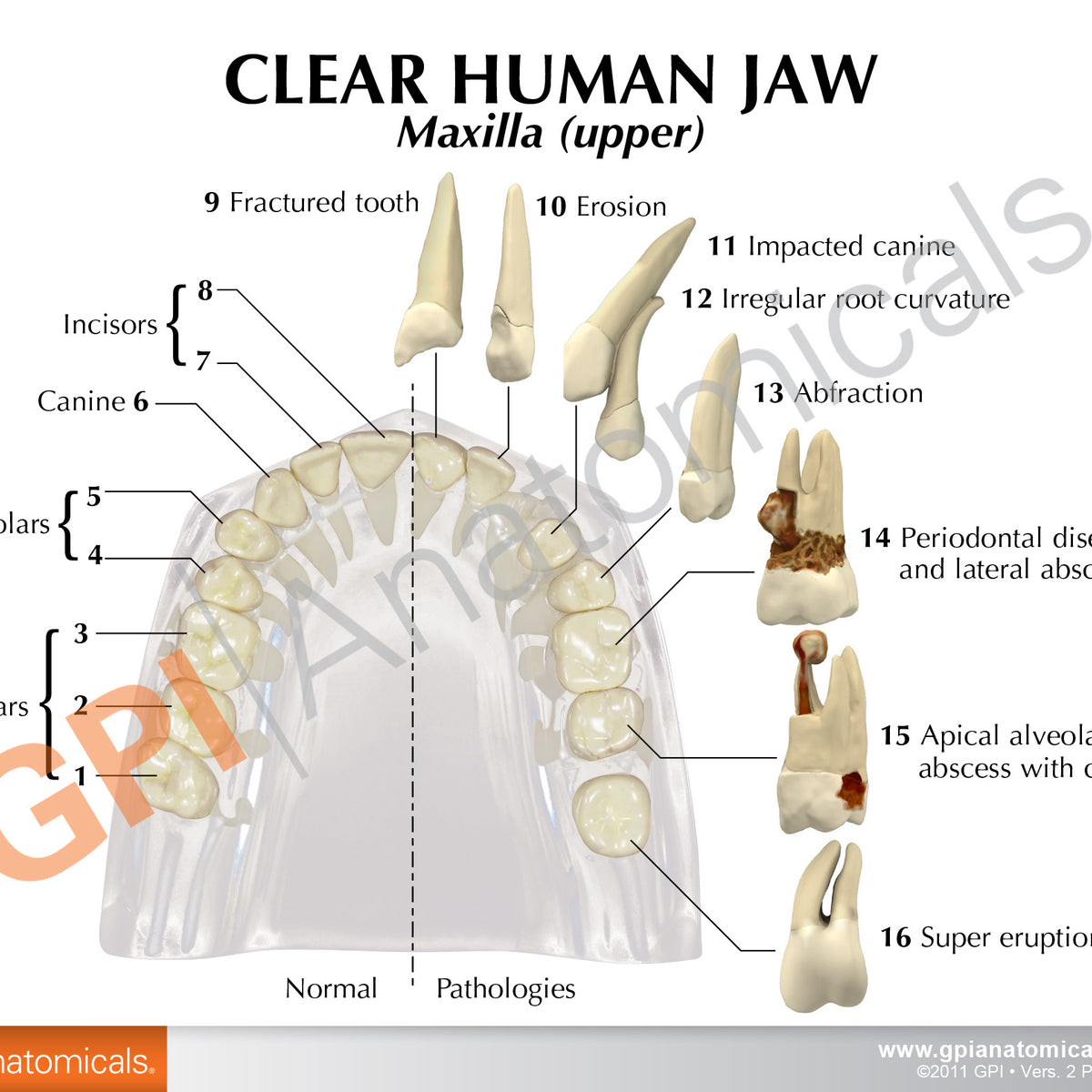 Clear Teeth Education Card – GPI 3D Anatomy