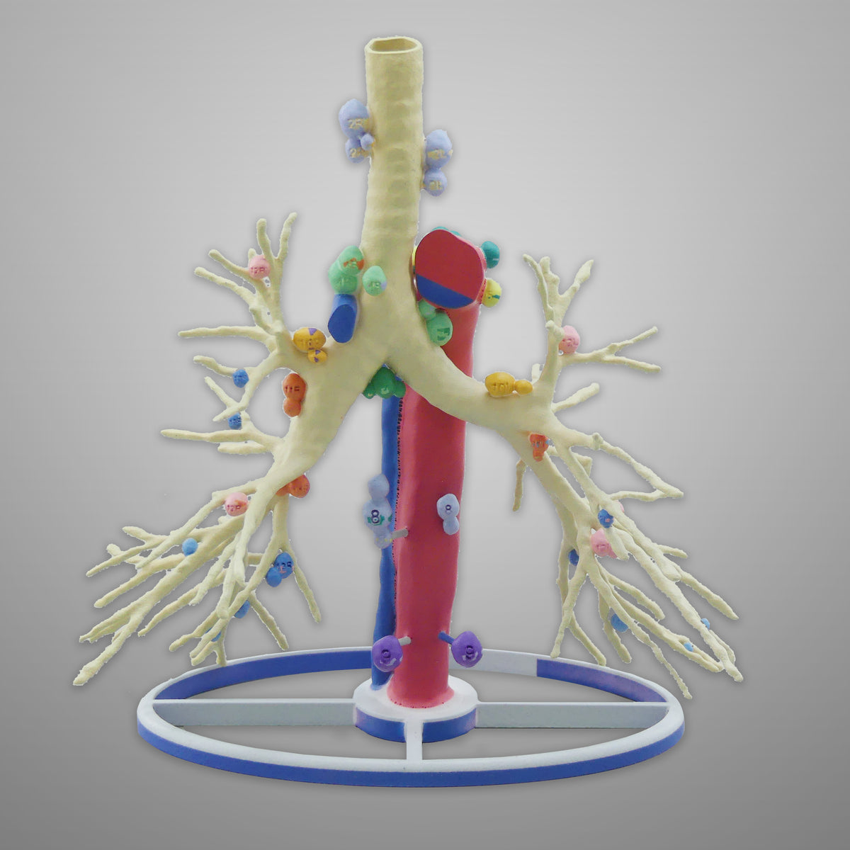 Custom 3D Anatomy Models | Tracheobronchial Tree With Lymph Nodes ...