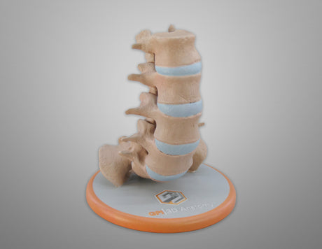 3D Printing Anatomical Models | GPI 3D Anatomy