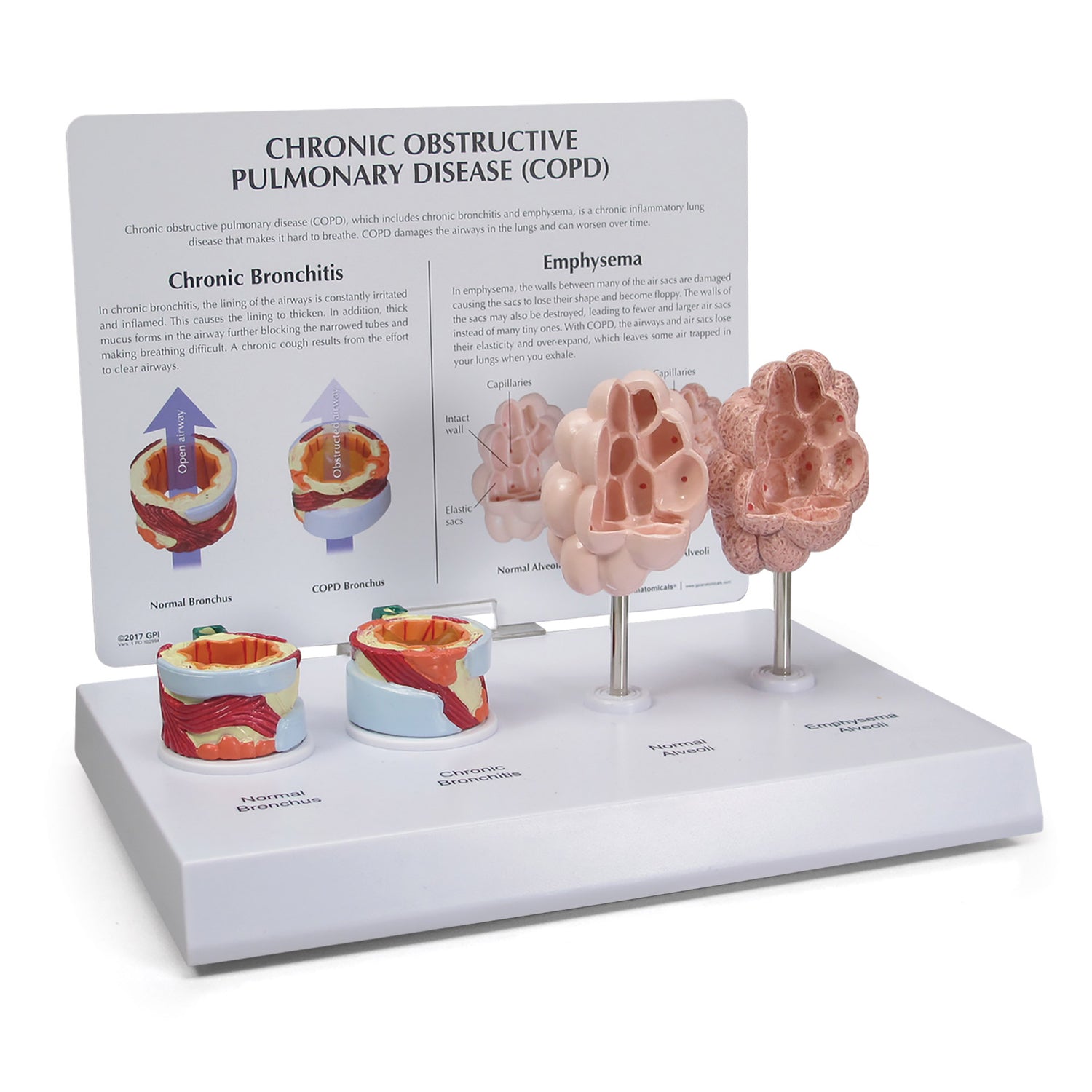 Respiratory System Model with Chronic Obstructive Pulmonary Disease (C ...