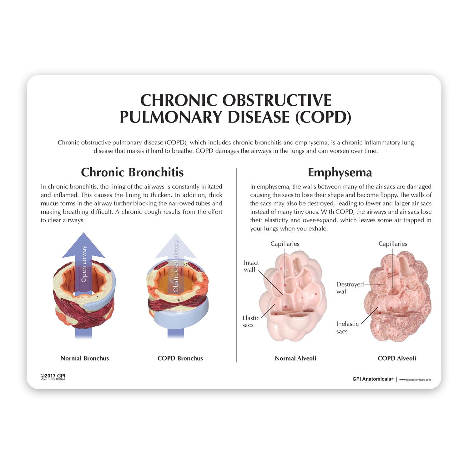 Respiratory System Model with Chronic Obstructive Pulmonary Disease (C ...