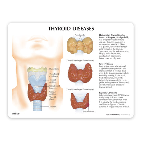 Thyroid Model Set – GPI 3D Anatomy