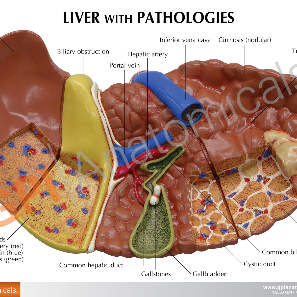 Liver Cancer Education Card – GPI 3D Anatomy