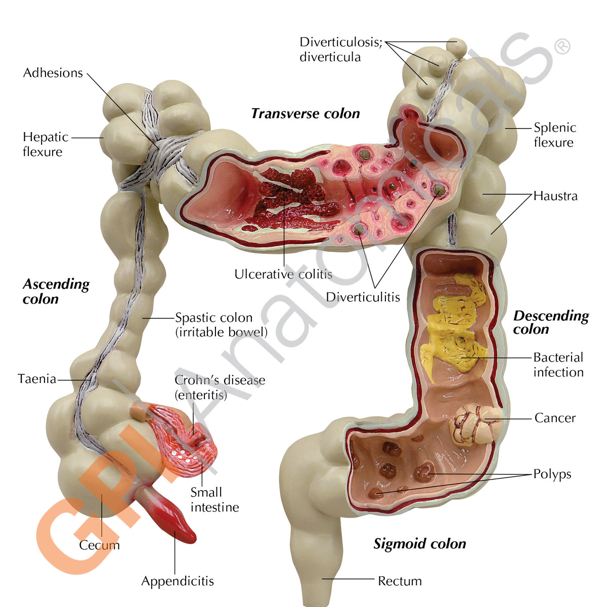 Colon Education Card – GPI 3D Anatomy