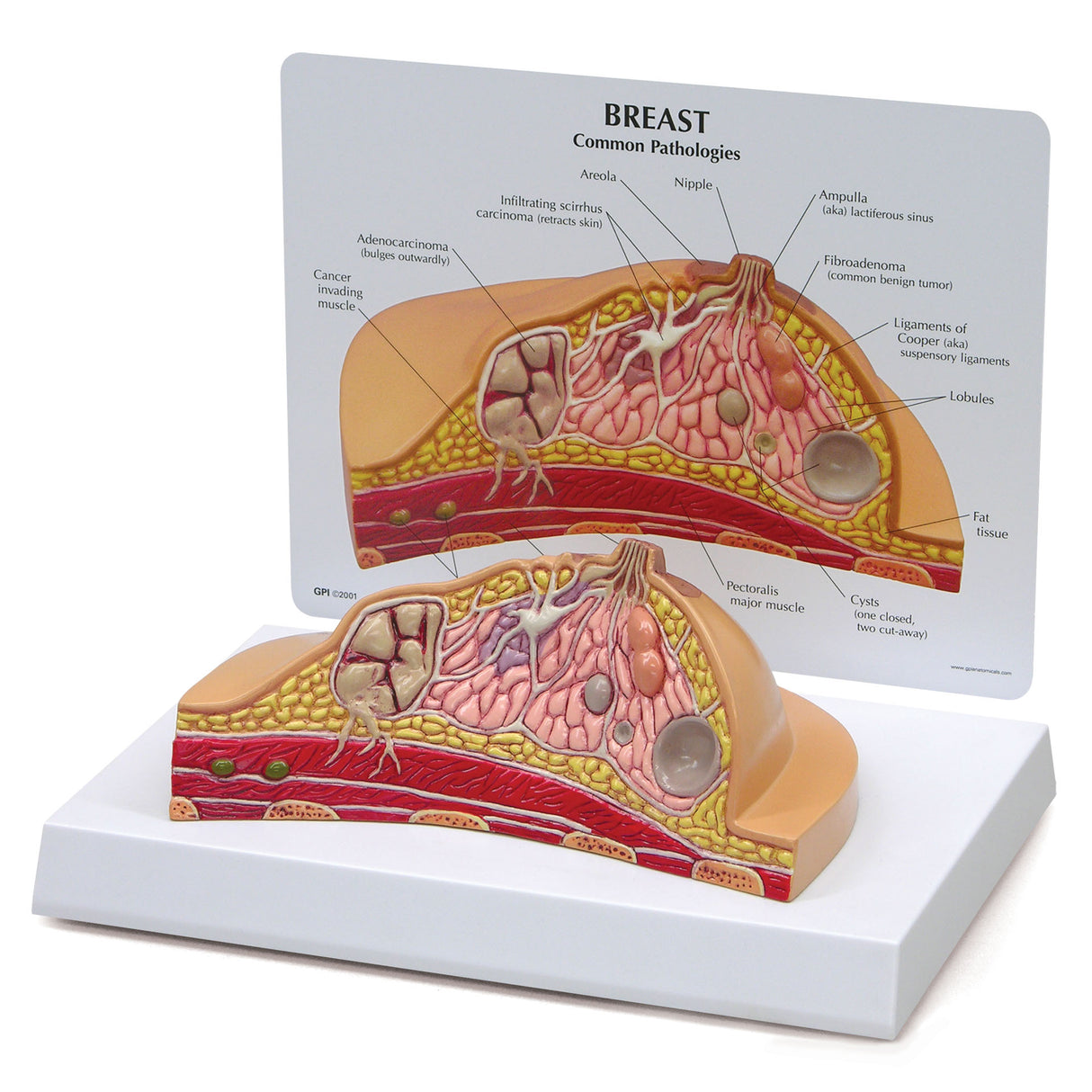 Breast Cross-Section Model – GPI 3D Anatomy