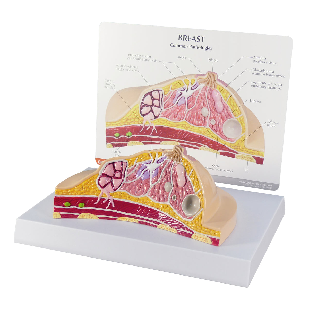 Breast Cross-Section Model – GPI 3D Anatomy