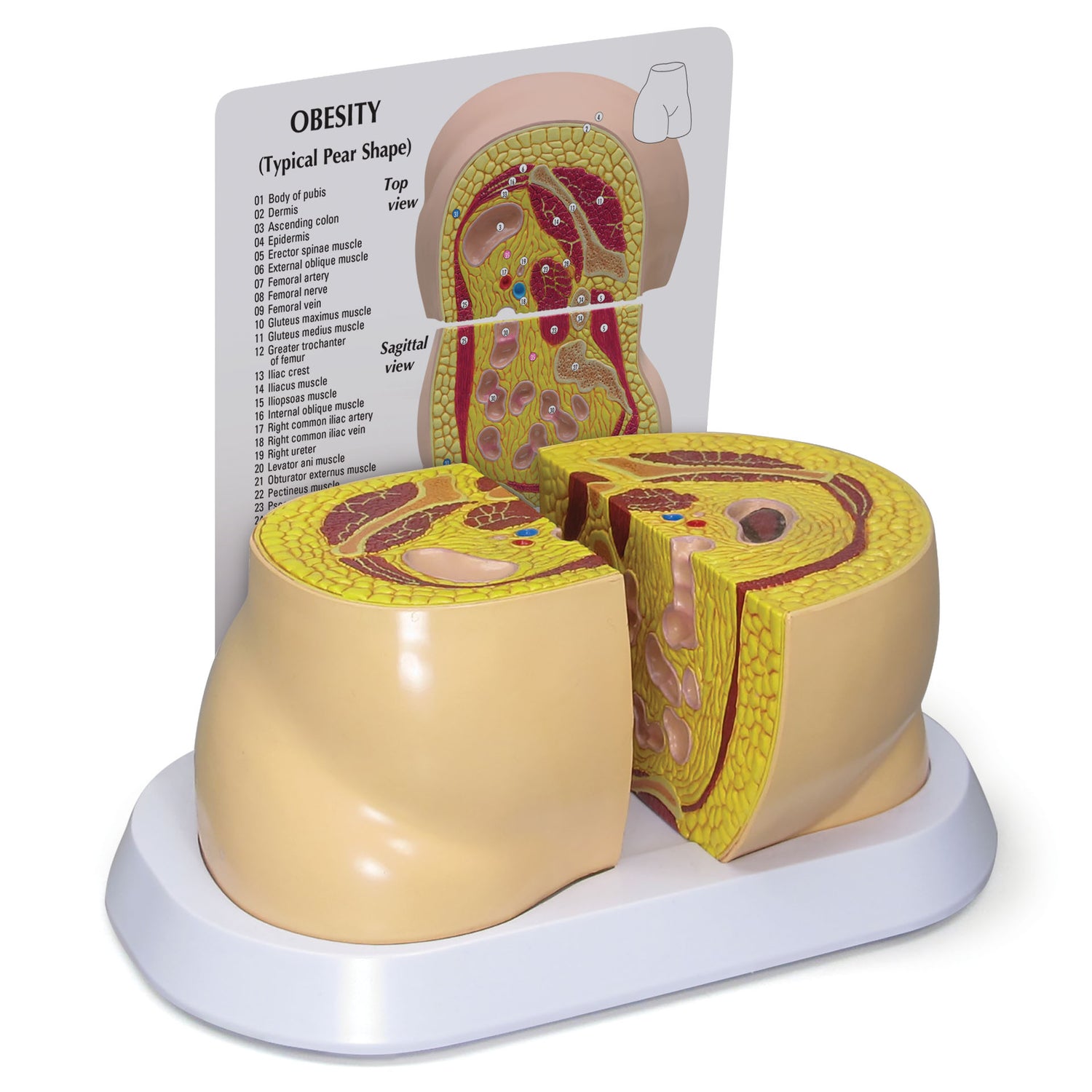 Obesity Model – GPI 3D Anatomy