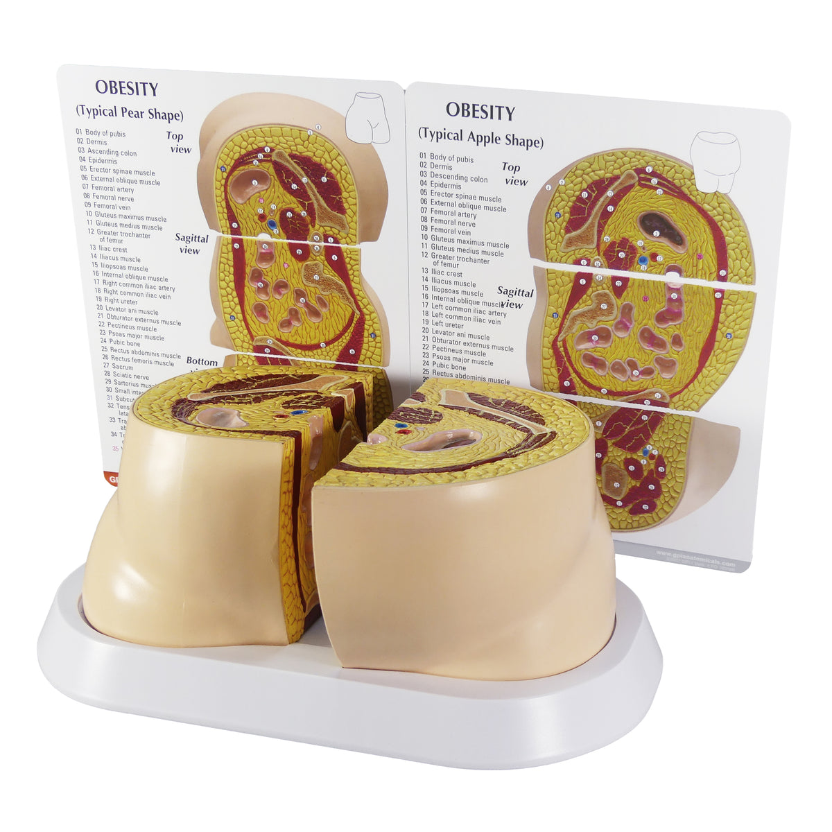 Obesity Model – GPI 3D Anatomy