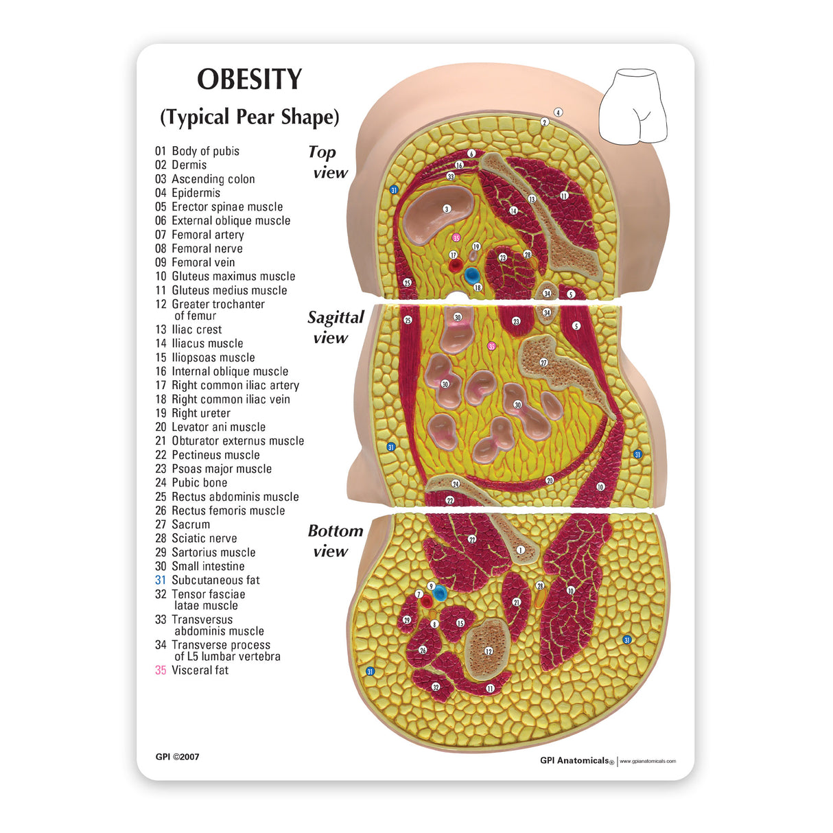 Obesity Model – GPI 3D Anatomy