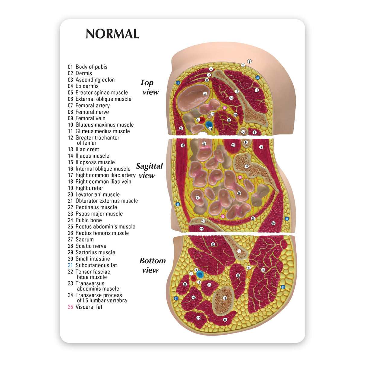 Obesity Model – GPI 3D Anatomy