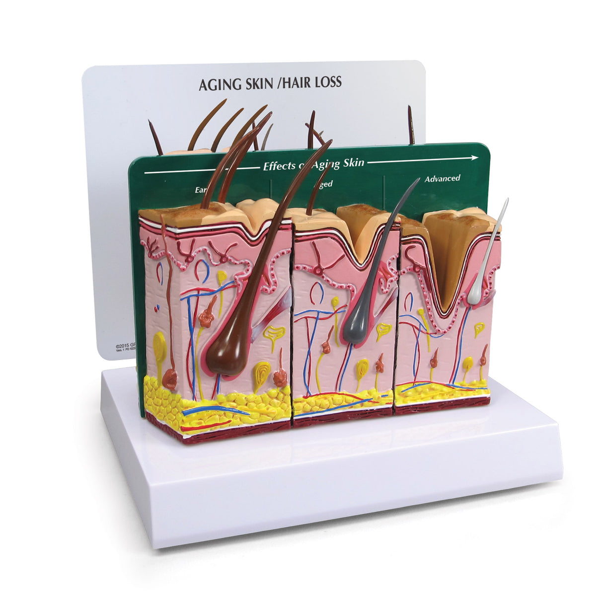 Aging Skin and Hair Loss Model – GPI 3D Anatomy