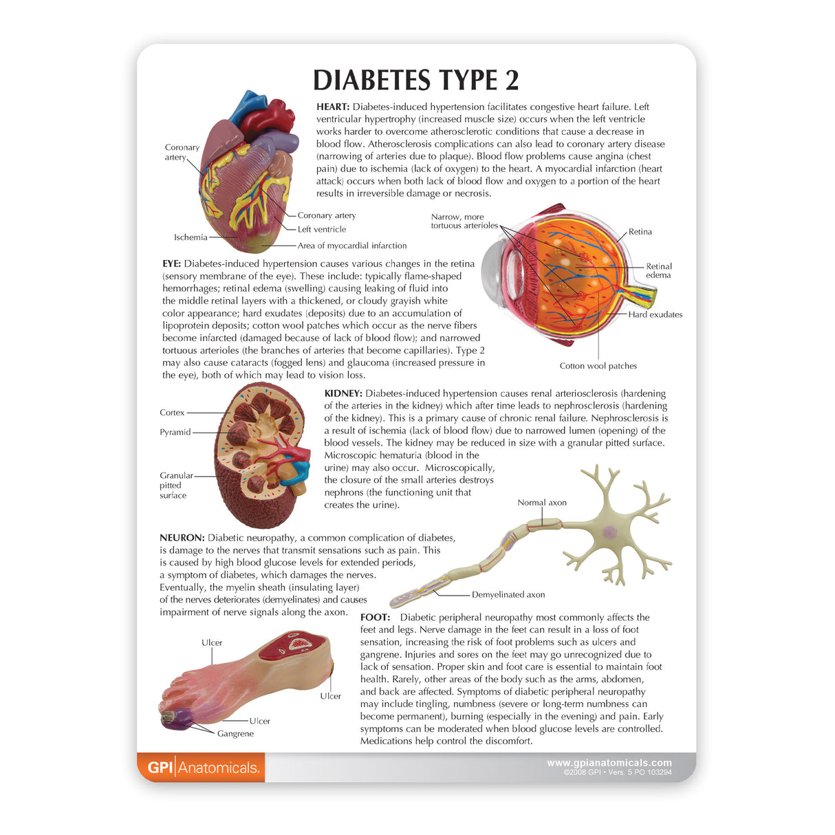 Type II Diabetes Model Set – GPI 3D Anatomy