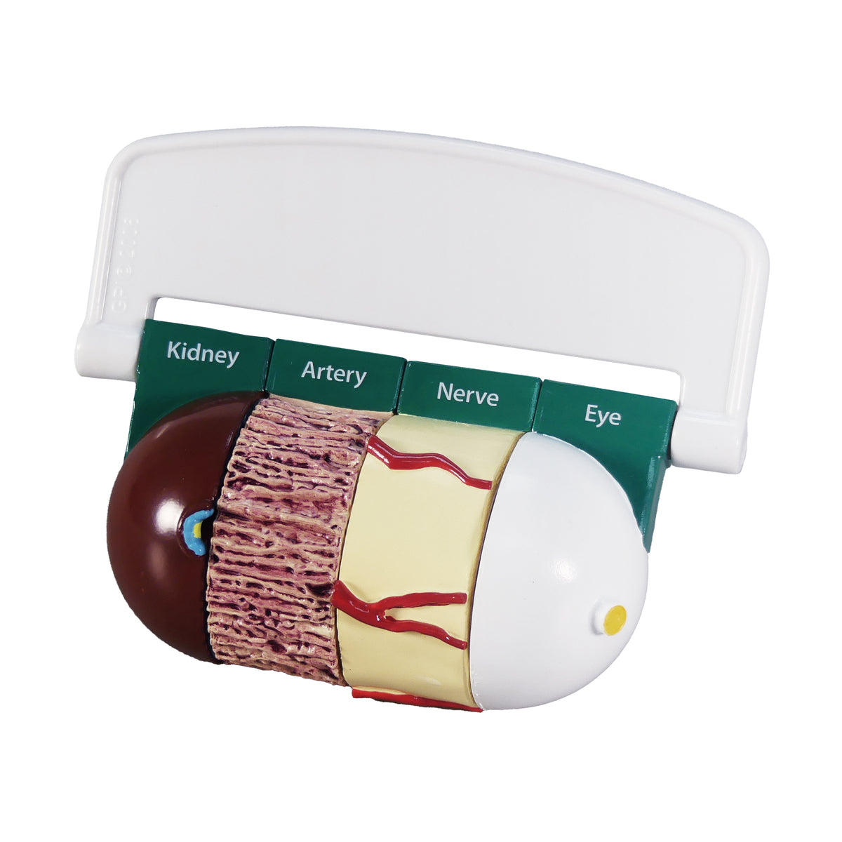 4-Piece Diabetes Model – GPI 3D Anatomy