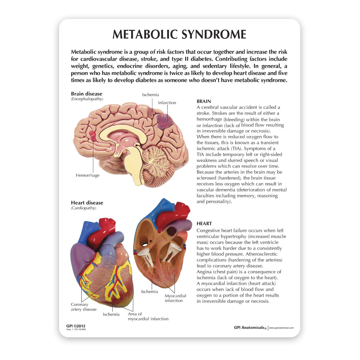 Metabolic Syndrome Education Card – GPI 3D Anatomy