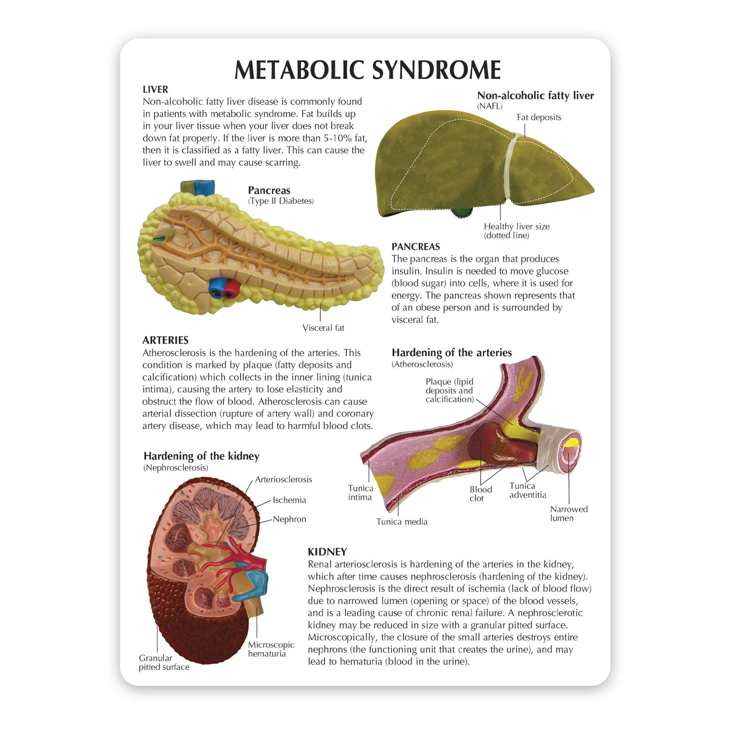 Metabolic Syndrome Model Set – GPI 3D Anatomy
