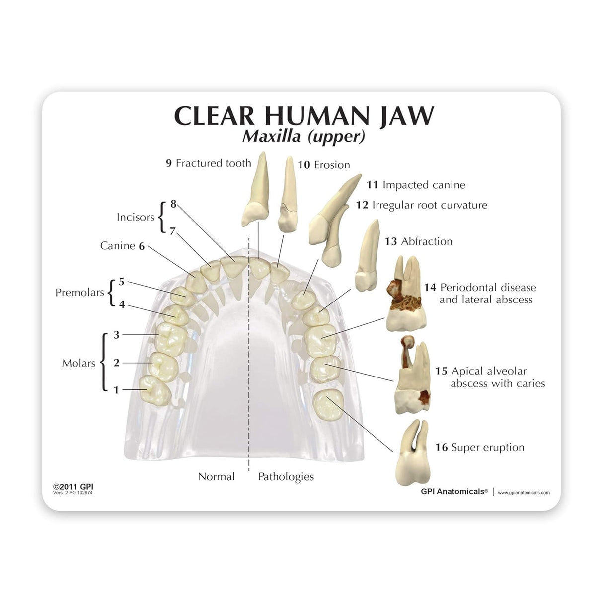 Clear Teeth Education Card – GPI 3D Anatomy