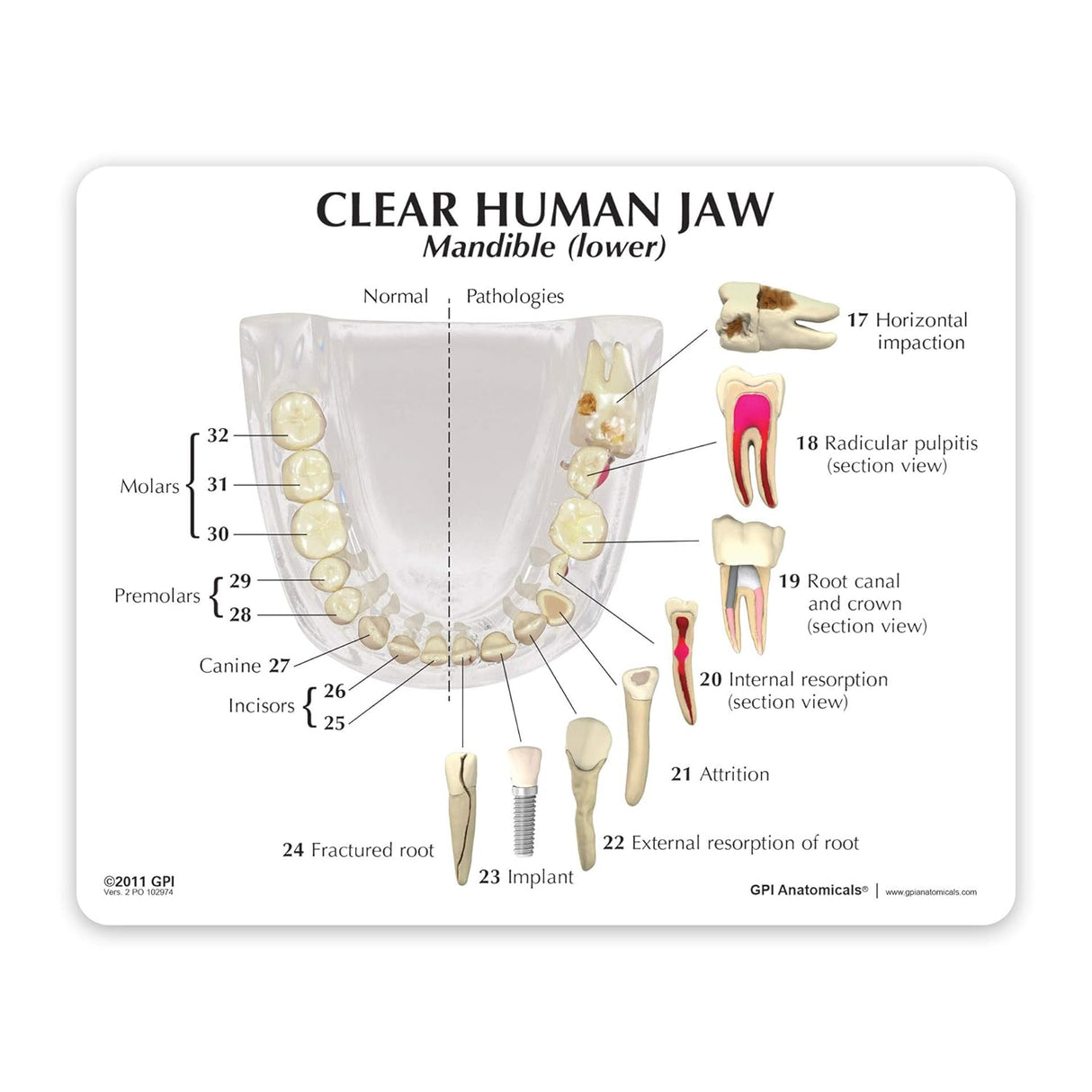 Clear Teeth Education Card – GPI 3D Anatomy