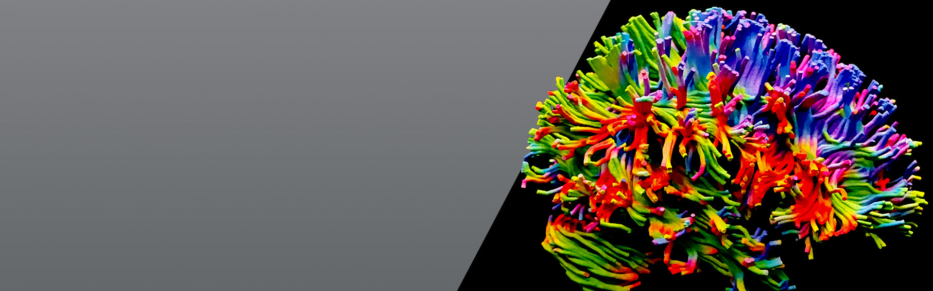 3D Printing Anatomical Models | GPI 3D Anatomy