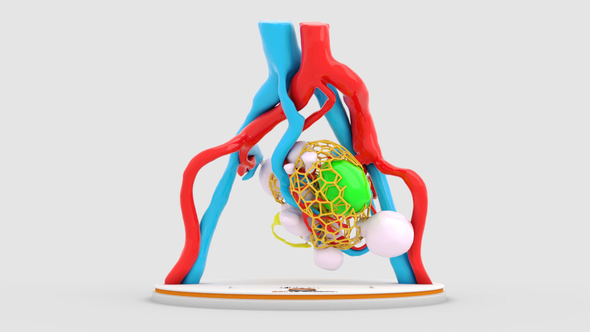 Custom 3D Anatomy Models | Kidney Disease | Kidney Neoplasm | Kidney ...