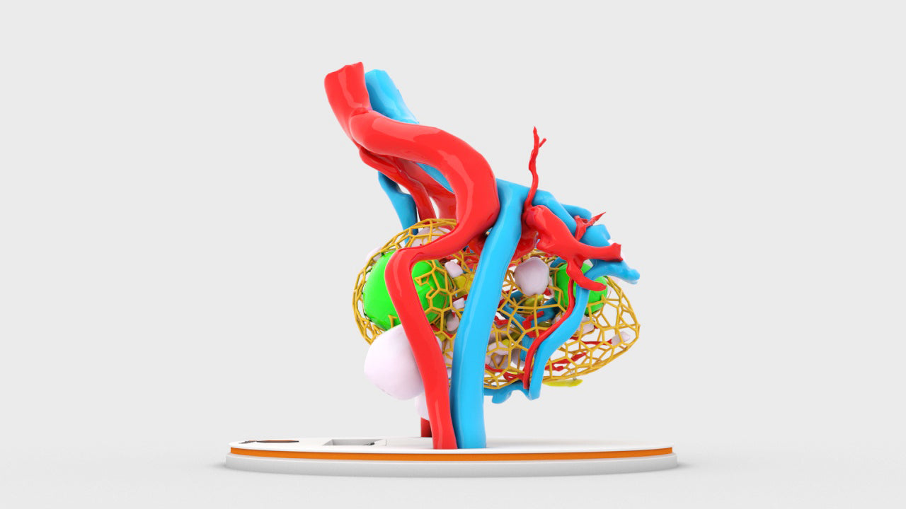 Custom 3D Anatomy Models | Kidney Disease | Kidney Neoplasm | Kidney ...