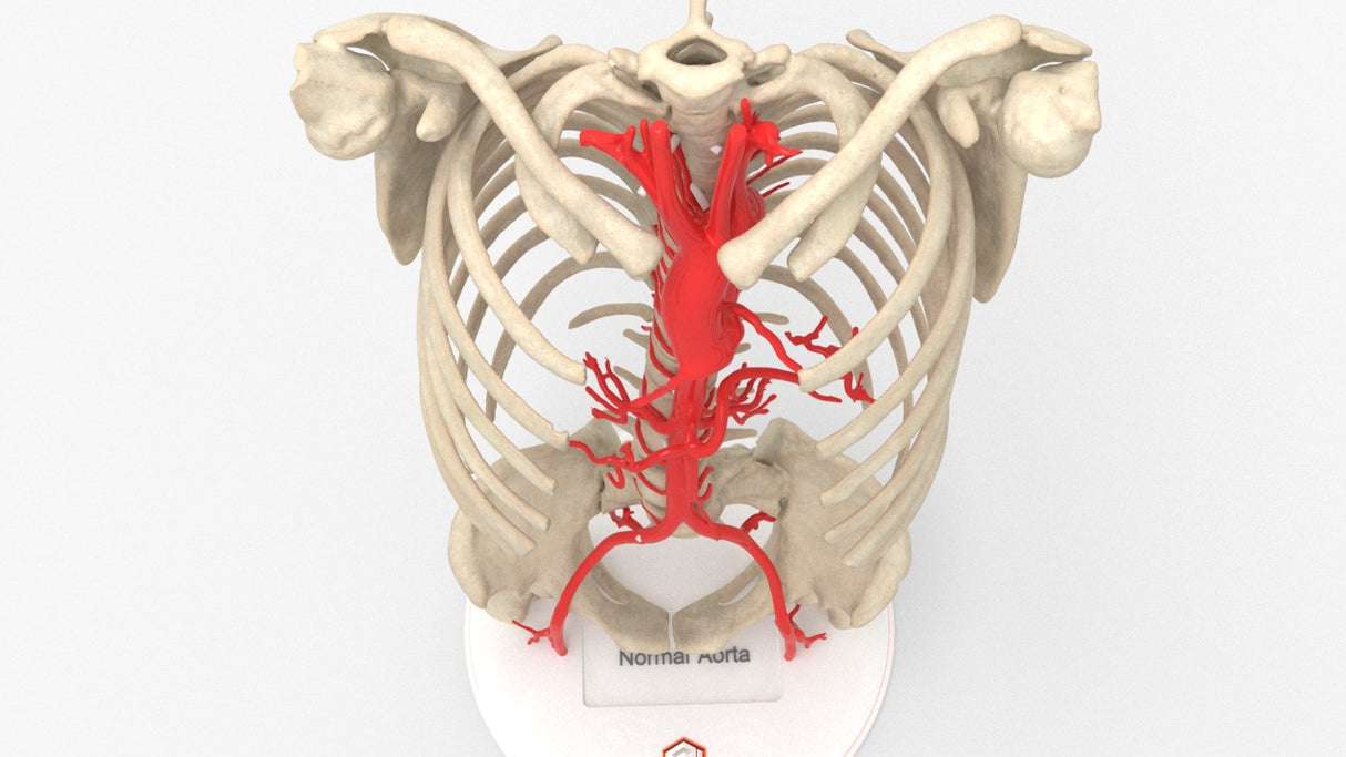 Custom 3D Anatomy Models | Aorta | Aortic Valve | Aortic Arch ...