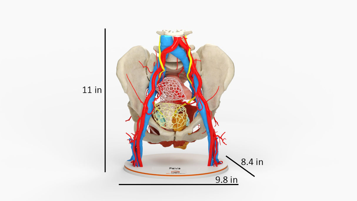 Custom 3D Anatomy Models | Perineal Hernia | Pelvic Floor Dysfunction ...