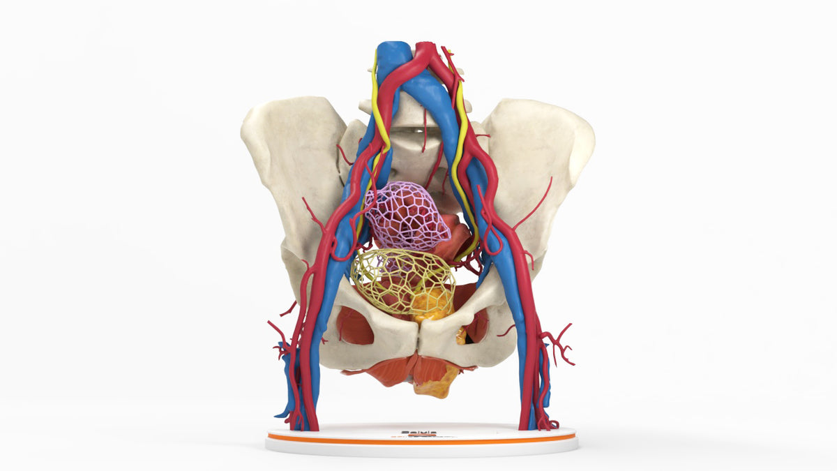 Custom 3D Anatomy Models | Perineal Hernia | Pelvic Floor Dysfunction ...