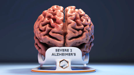 Custom 3D Anatomy Models | Adult Brain | Cerebellum | Cerebrum ...