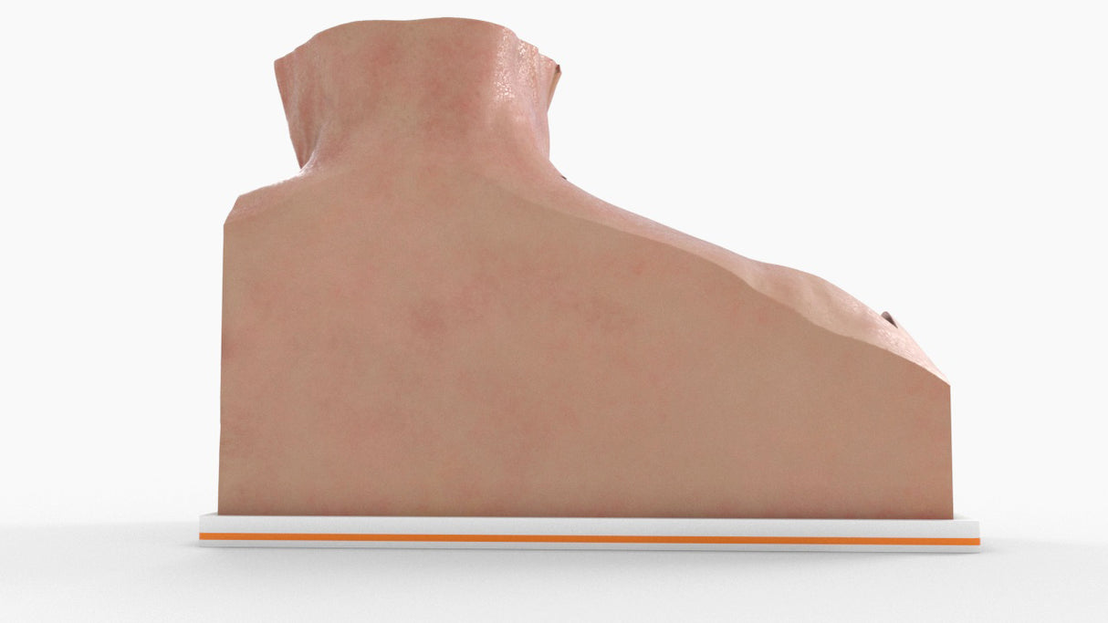 Custom 3D Anatomy Models | Thoracic Outlet Syndrome (TOS) | Thoracic ...