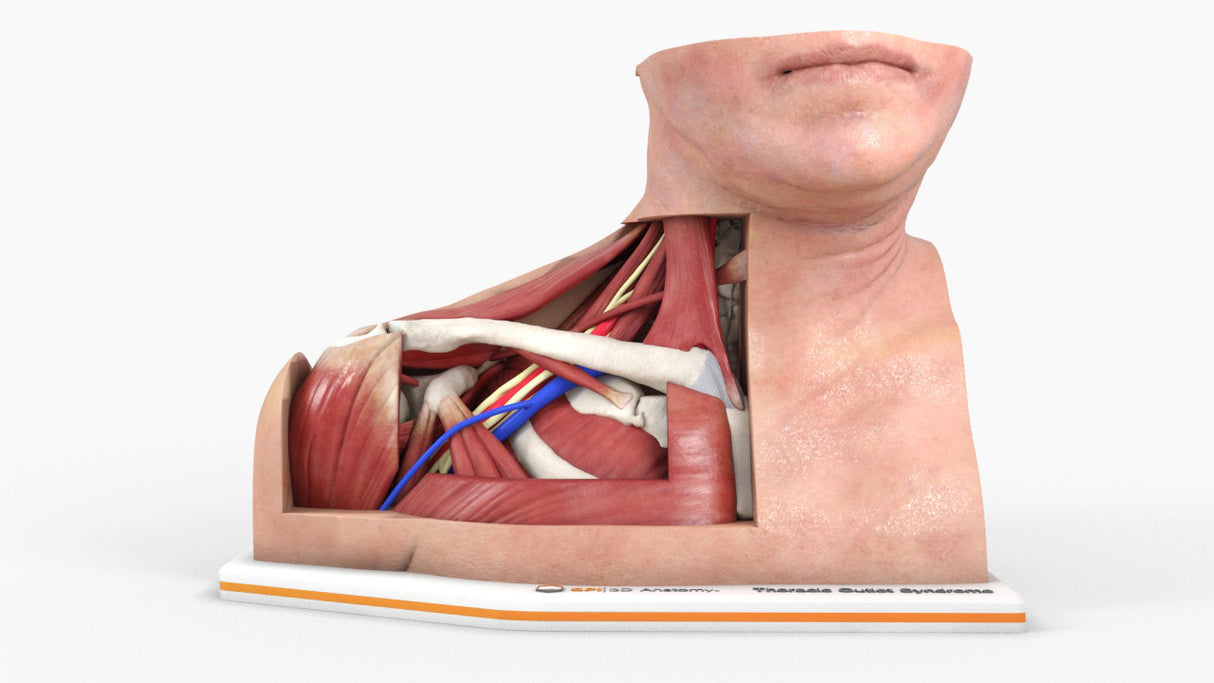 Custom 3D Anatomy Models | Thoracic Outlet Syndrome (TOS) | Thoracic ...