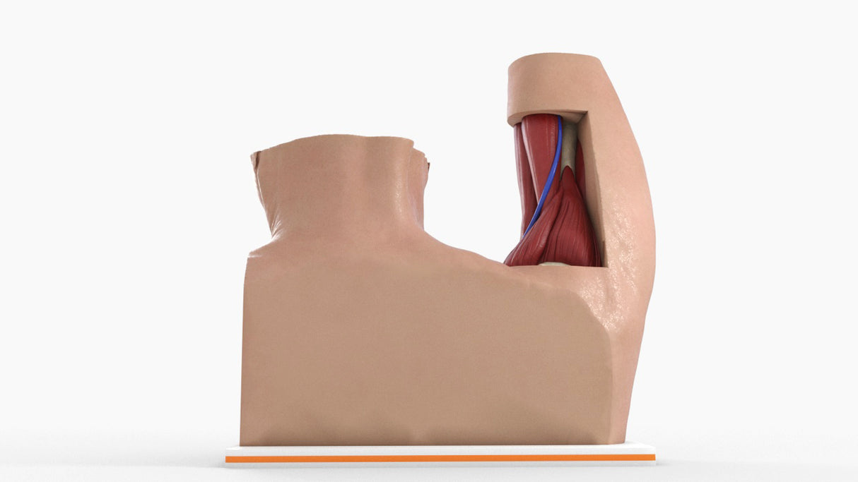 Custom 3D Anatomy Models | Thoracic Outlet Syndrome (TOS) | Thoracic ...