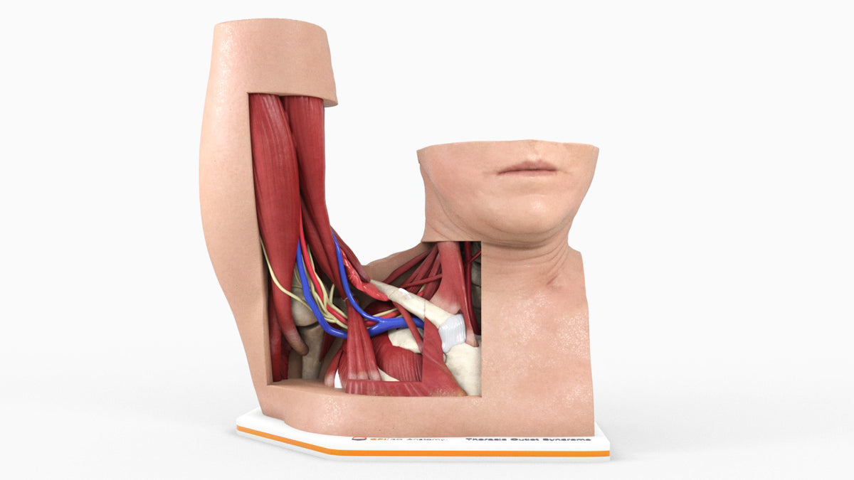 Custom 3D Anatomy Models | Thoracic Outlet Syndrome (TOS) | Thoracic ...