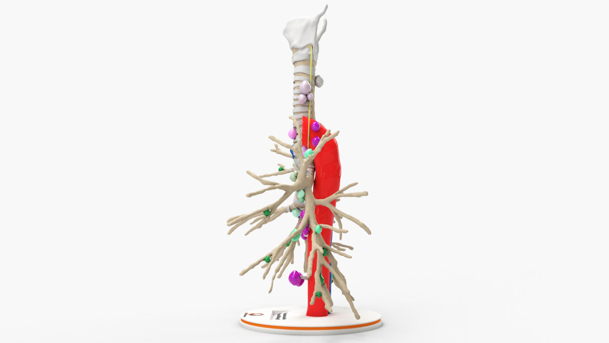 Custom 3D Anatomy Models | Tracheobronchial Tree With Lymph Nodes ...