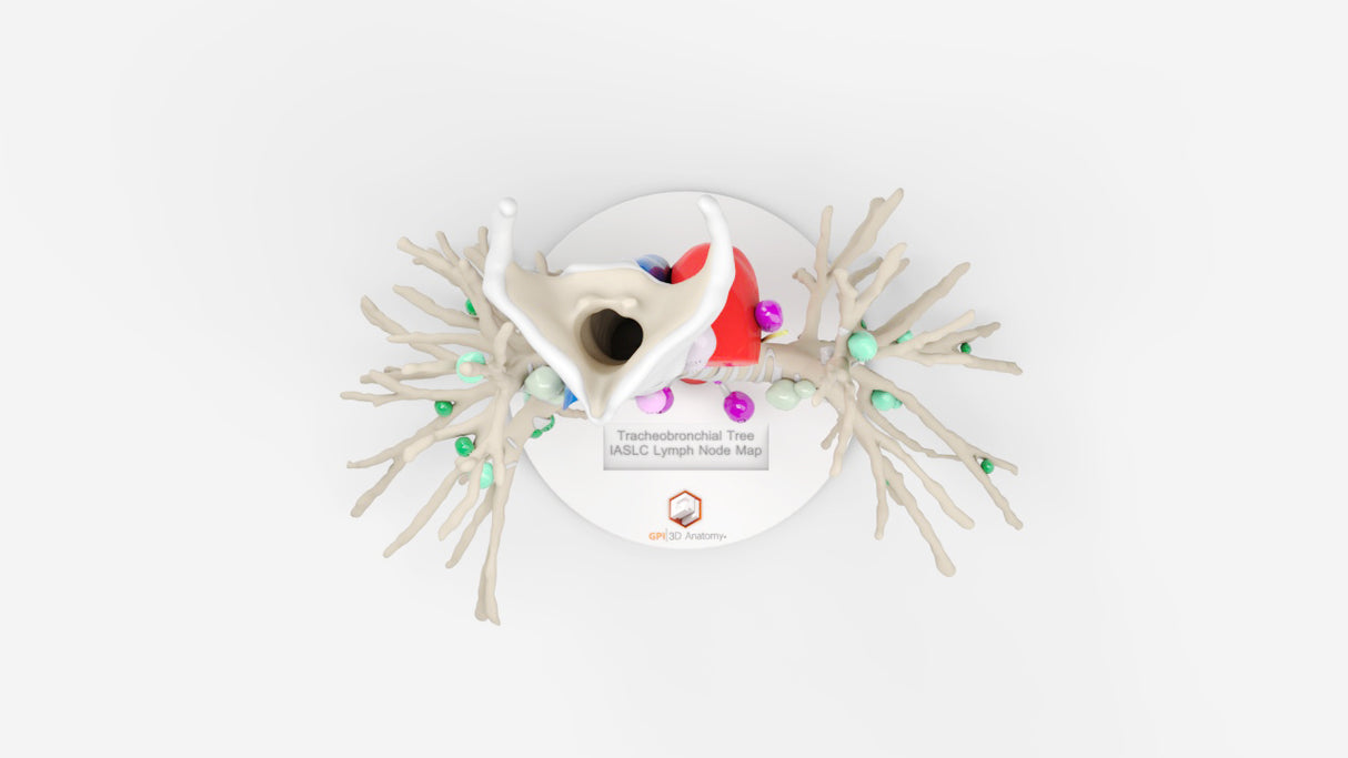 Custom 3D Anatomy Models | Tracheobronchial Tree With Lymph Nodes ...
