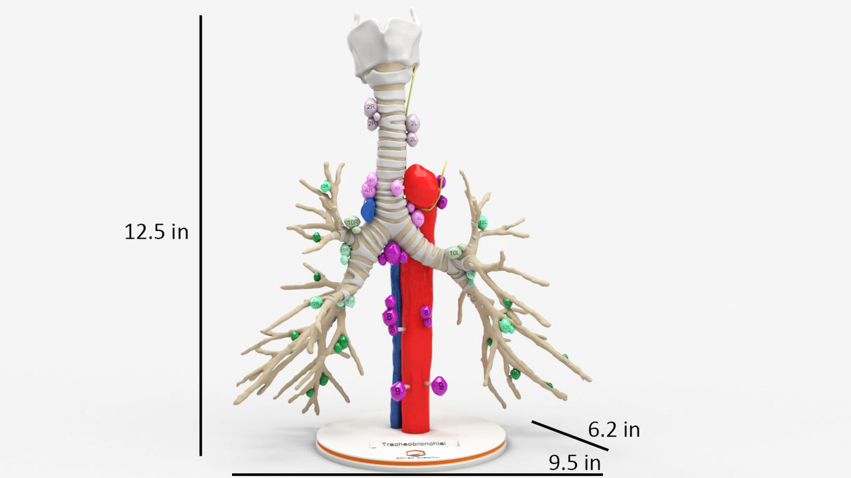 Custom 3D Anatomy Models | Tracheobronchial Tree With Lymph Nodes ...