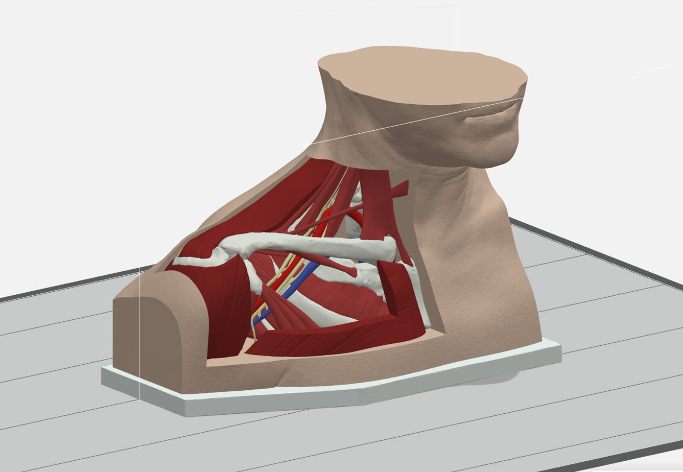 Custom 3D Anatomy Models | Thoracic Outlet Syndrome (TOS) | Thoracic ...
