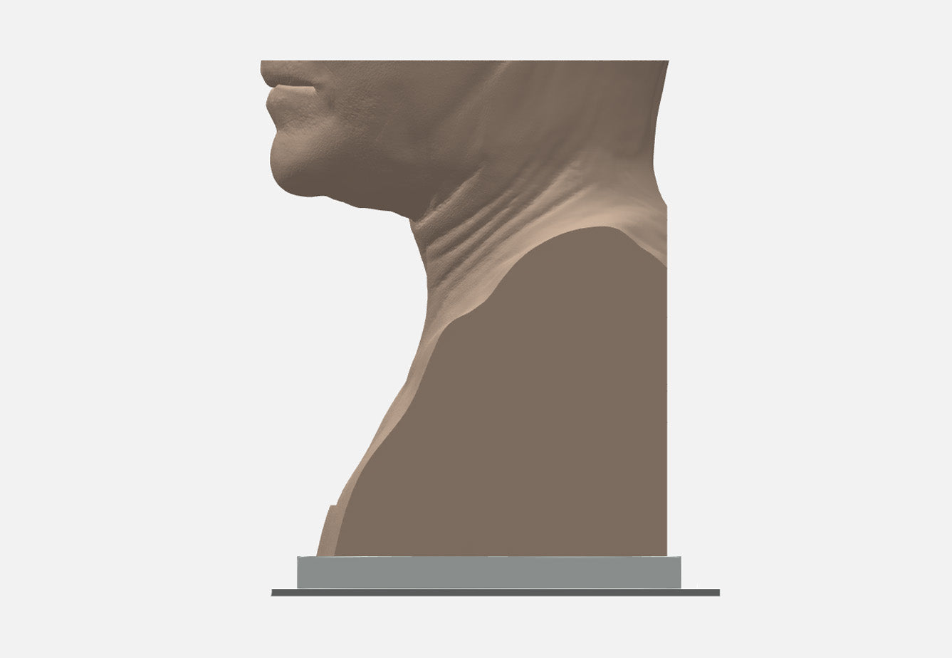 Custom 3D Anatomy Models | Thoracic Outlet Syndrome (TOS) | Thoracic ...