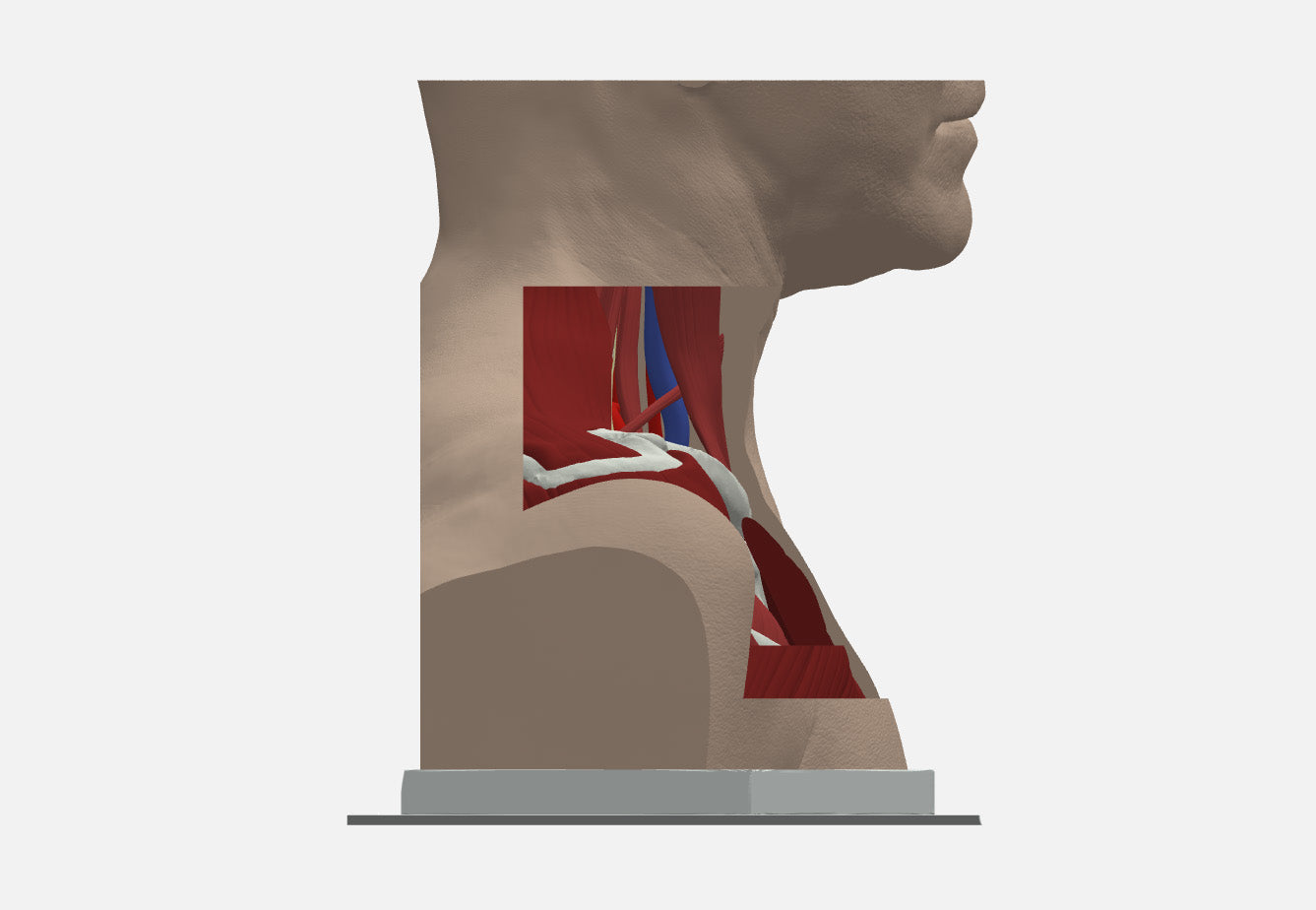 Custom 3D Anatomy Models | Thoracic Outlet Syndrome (TOS) | Thoracic ...